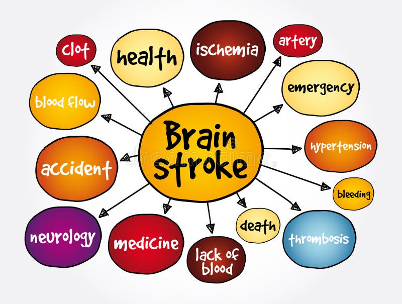 Brain Stroke Mind Map, Medical Concept for Presentations and Reports Stock Illustration ...