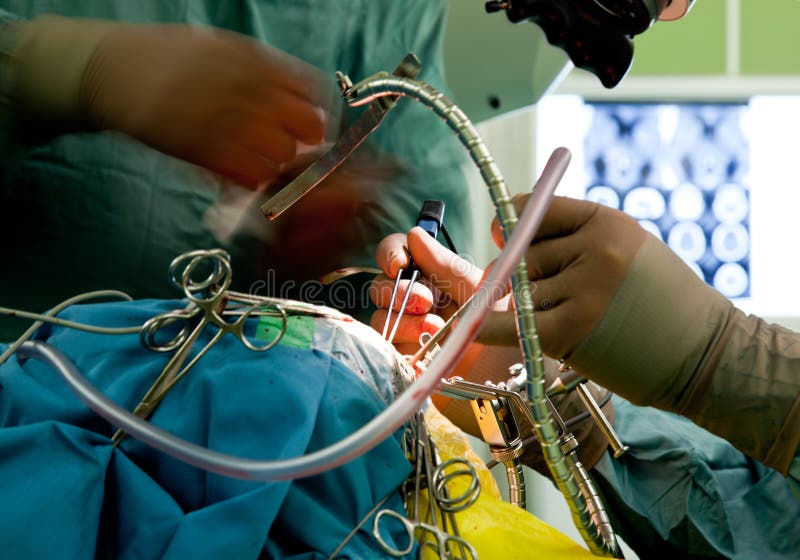 Brain Surgery Wallpaper