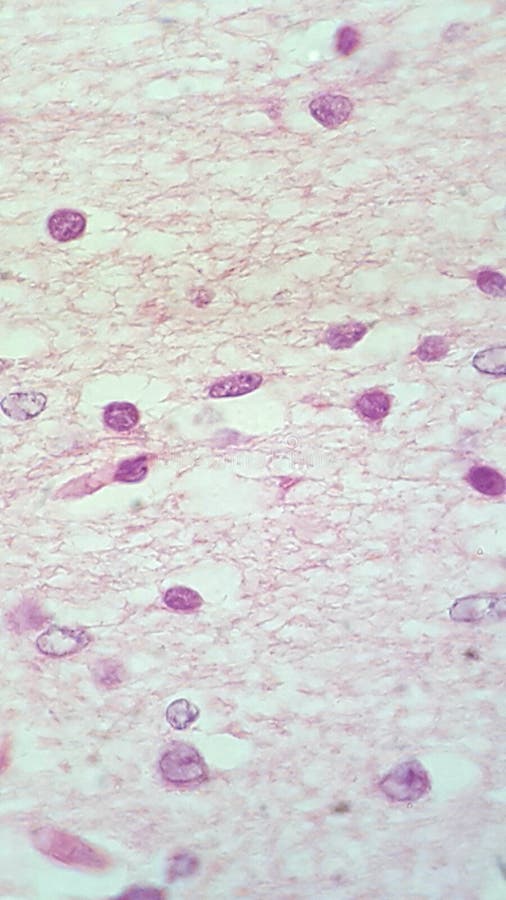 Human Brain Tissue Microphotography Under Optic Microscope at 1000x ...