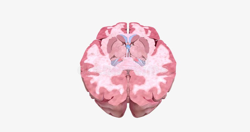 The Brain Transverse (Axial) Cross Section Stock Illustration ...