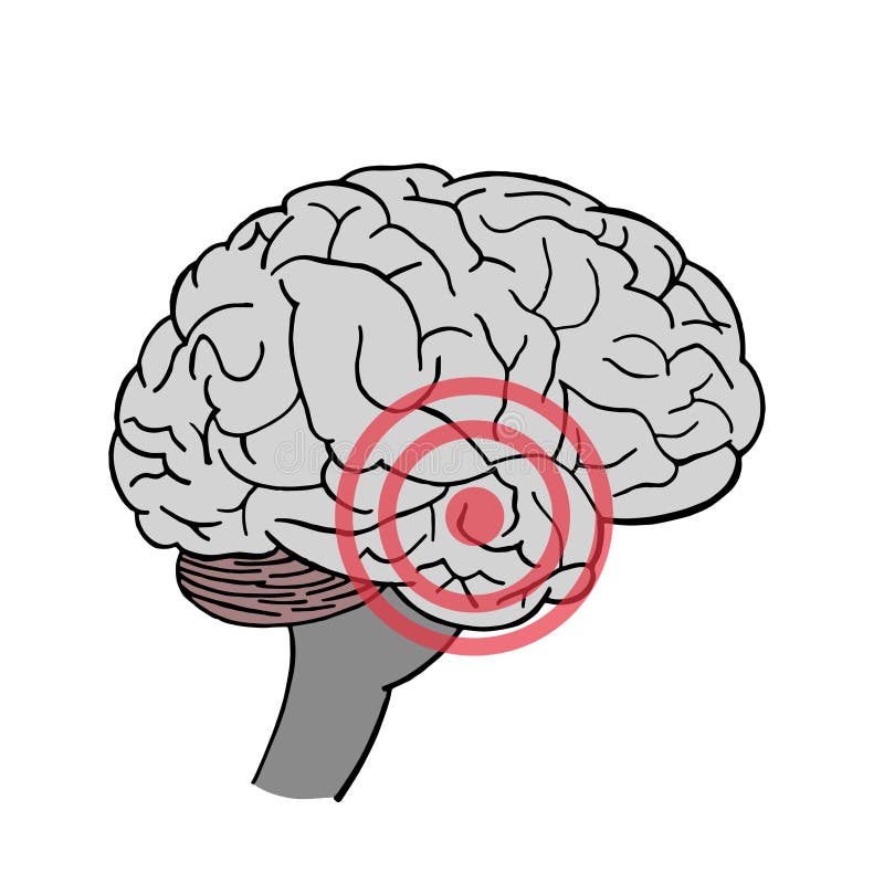 Brain in vector. Headache stock vector. Illustration of nervous - 61601875