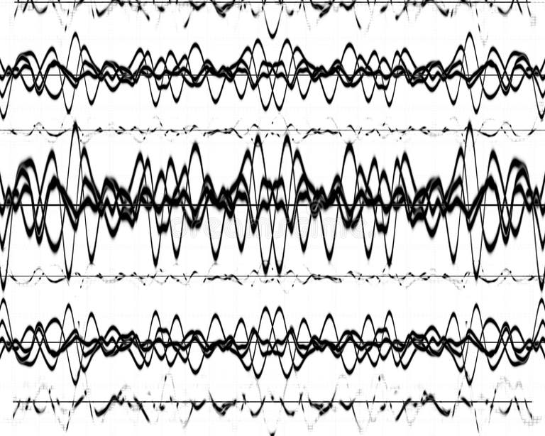 Brainwave Eeg Stock Illustrations – 110 Brainwave Eeg Stock ...