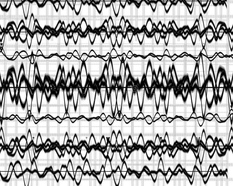 Brain Wave on Electroencephalogram EEG for Epilepsy Stock Illustration ...