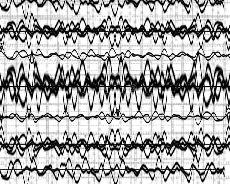 Brainwave Eeg Stock Illustrations – 110 Brainwave Eeg Stock ...