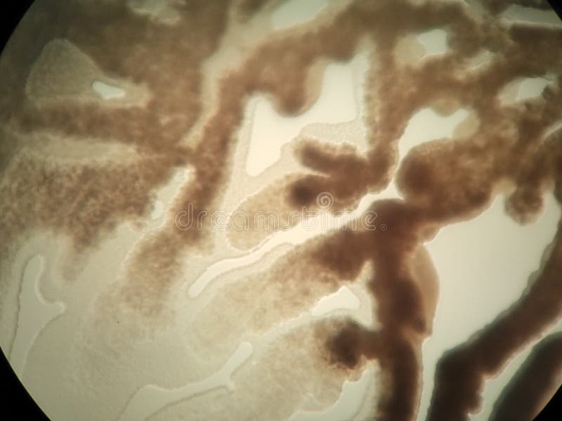 Branched Bacterial Colonies Under the Microscope Stock Image - Image of ...