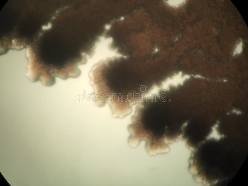 Branched Bacterial Colonies Under the Microscope Stock Photo - Image of ...