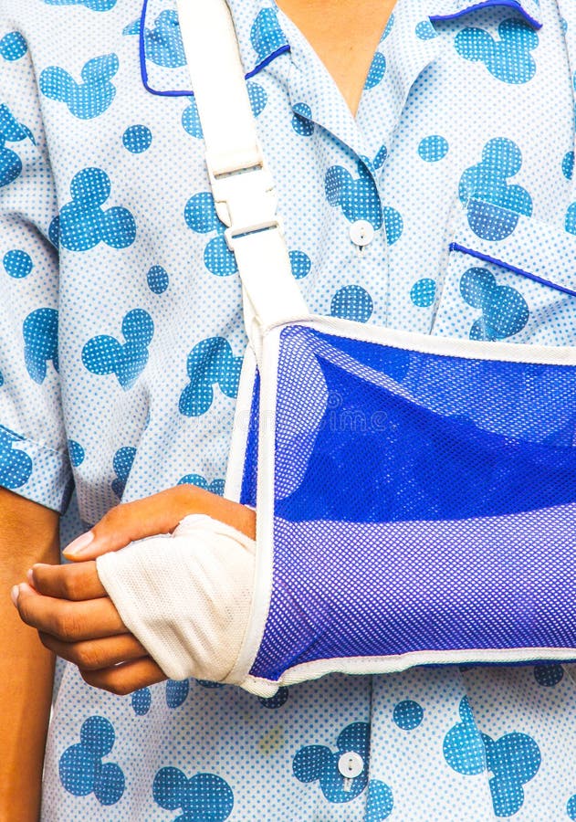 Fragmento Del Brazo Del Accidente Aislado En El Fondo Blanco,recorrido ...