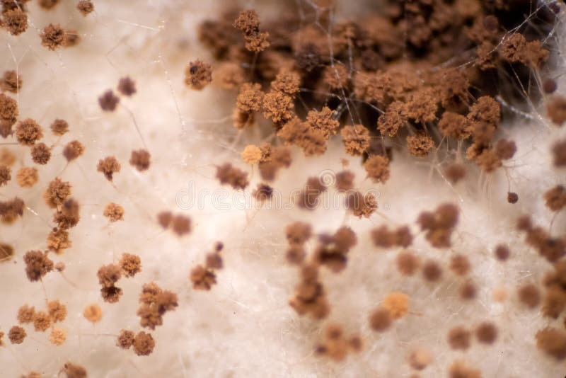 Bread Yeast Under Microscope