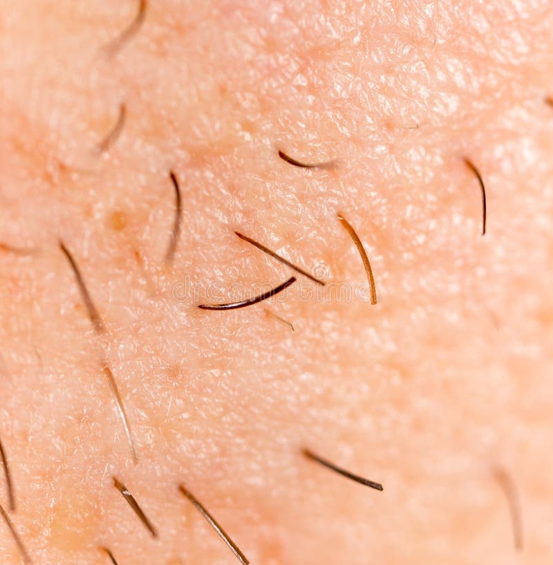 Bristles on the Beard of a Man Stock Image - Image of sparse, lips ...