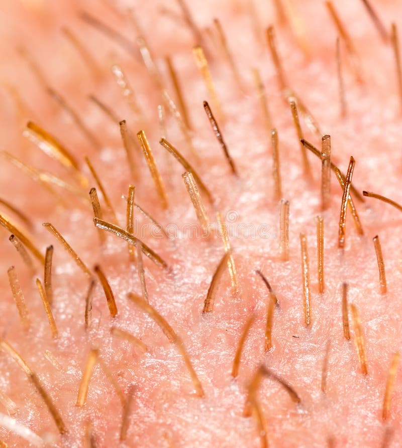 Bristles on the Beard of a Man Stock Image - Image of mouth, skin ...