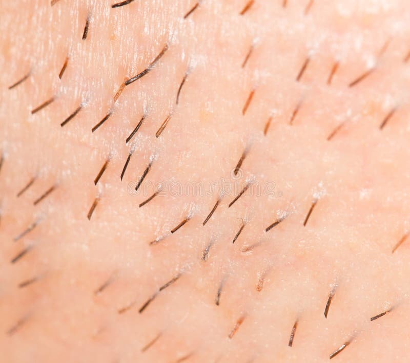 Bristles on the Skin. Close-up Stock Photo - Image of lips, mouth ...