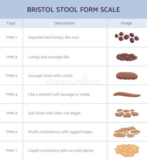 Bristol Stool Form Scale Infographic with Faeces Type Flat Vector ...