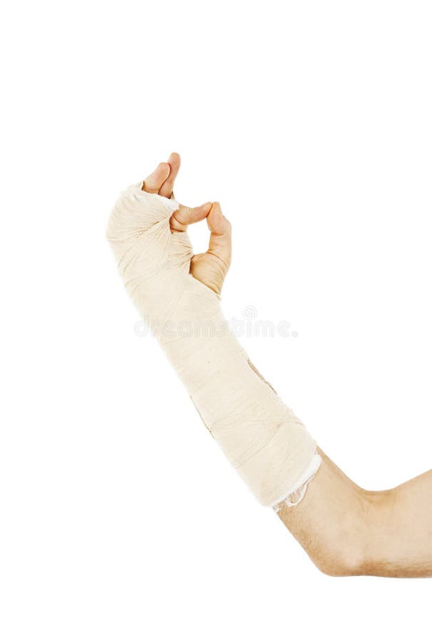 Broken Arm Bone Cast Making Ok Sign Stock Photos - Free & Royalty-Free ...