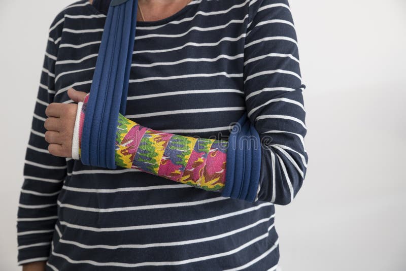 A Woman with a Broken Arm and a Bandage Around Her Neck Stock Photo ...