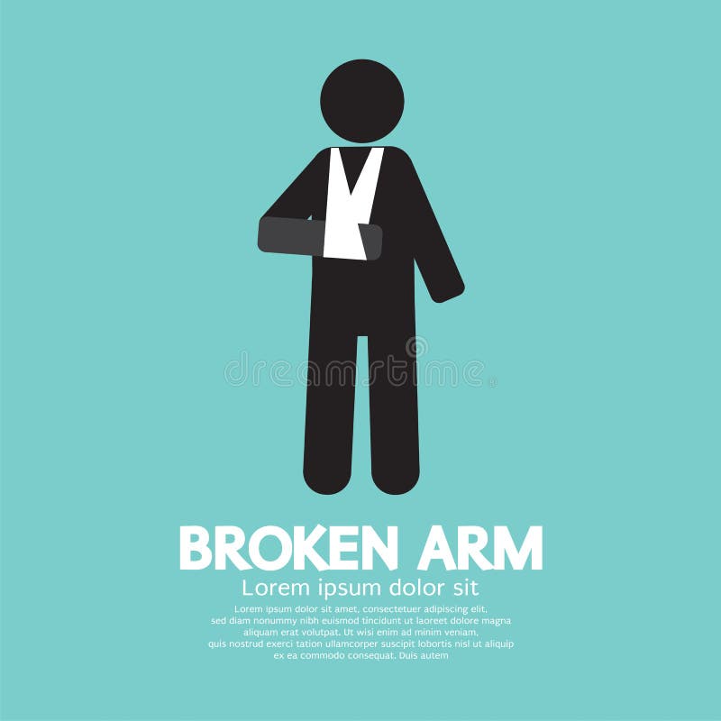 Broken Arm Graphic Symbol stock vector. Illustration of injury - 49723754