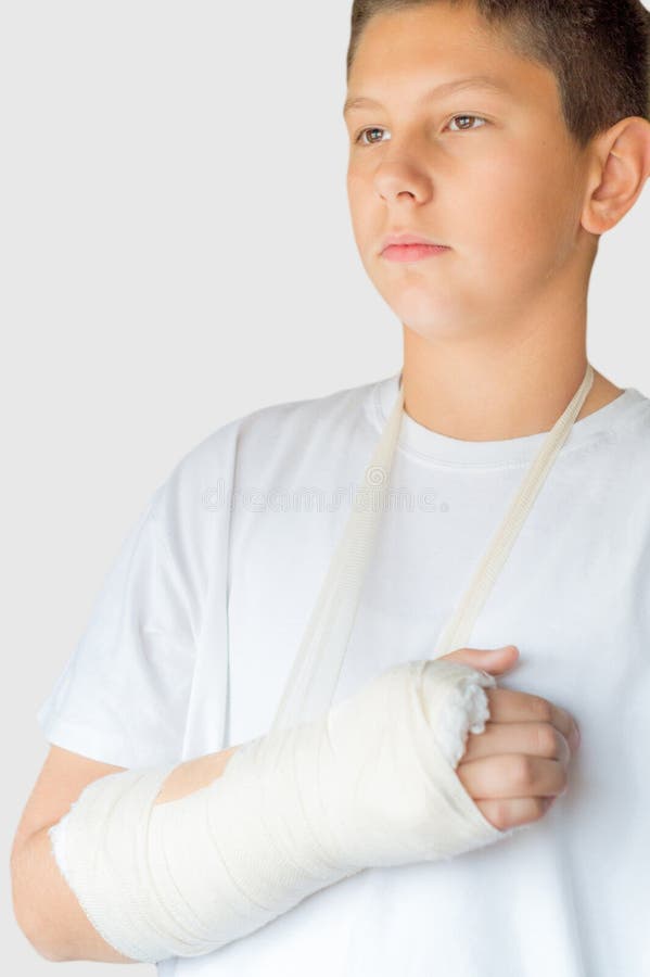 Broken Arm stock photo. Image of limb, isolated, male - 63607770