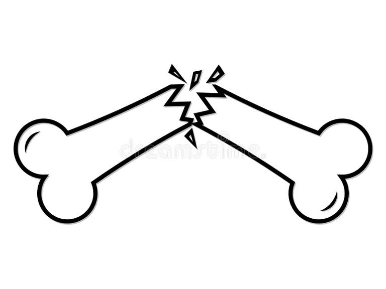 Bone Break Stock Illustrations – 2,312 Bone Break Stock Illustrations ...