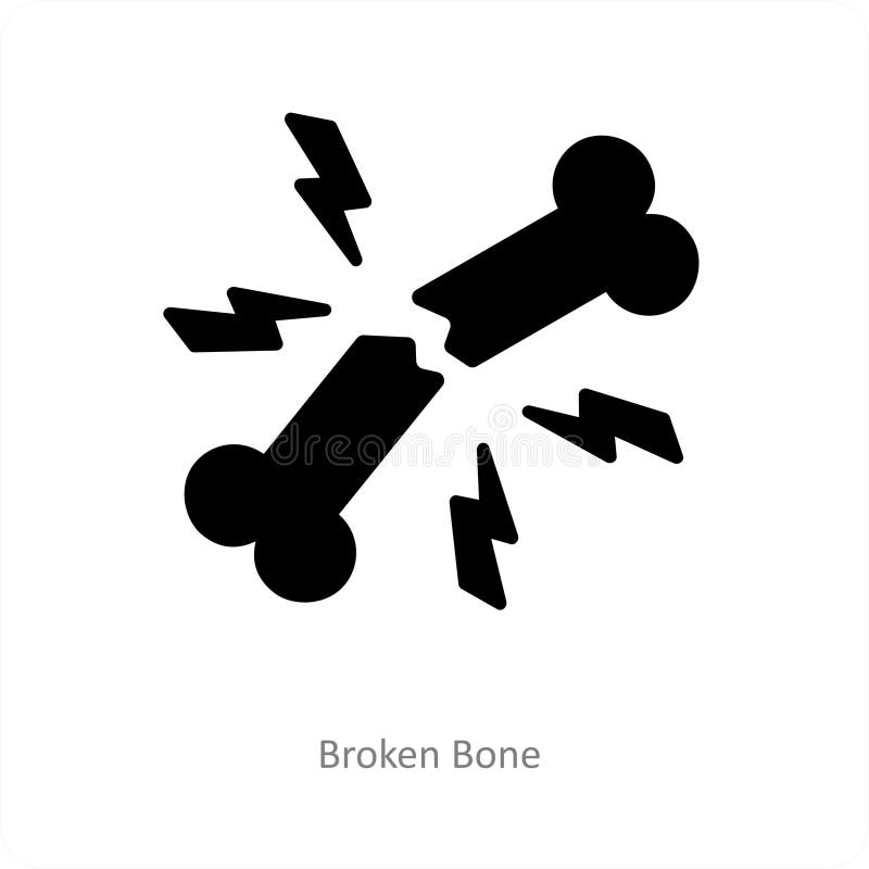 Broken bone stock illustration. Illustration of treatment - 265496600