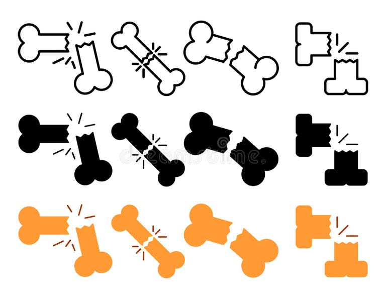 Broken bone icon vector stock vector. Illustration of injury - 348101886