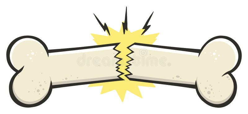 Broken Bone Line Cartoon Drawing Design Stock Illustration ...