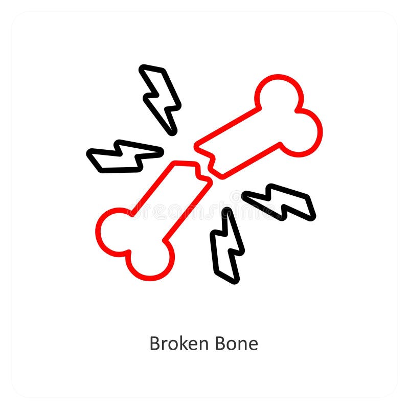 Broken Bone stock illustration. Illustration of bone - 338190815