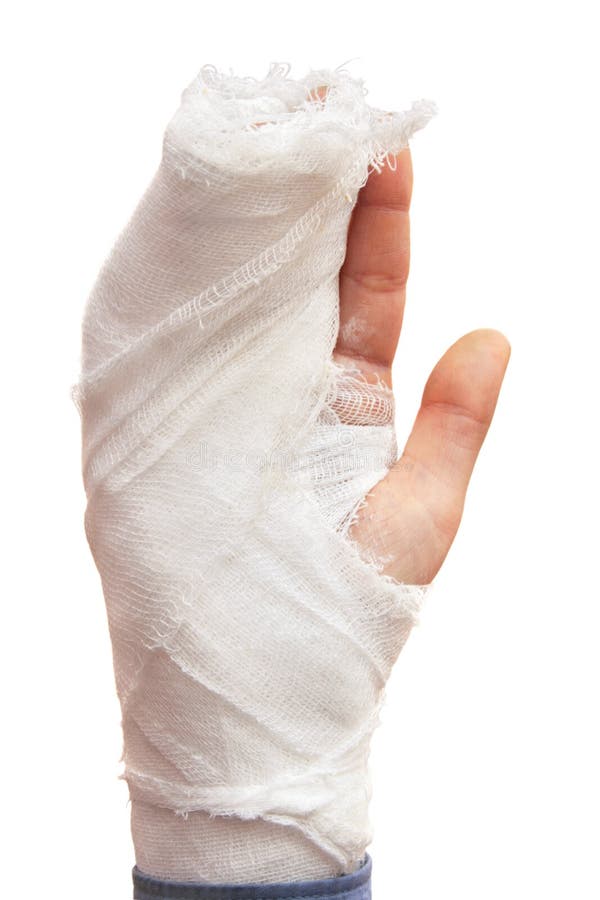 Broken hand. stock image. Image of pain, care, bone, domestic - 8183977