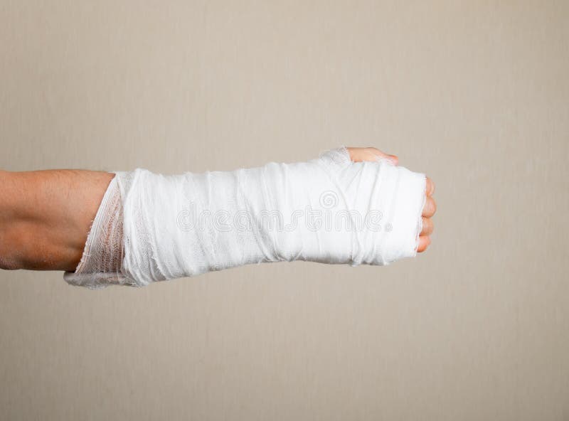 Broken hand with bandage stock image. Image of recovery - 69773033