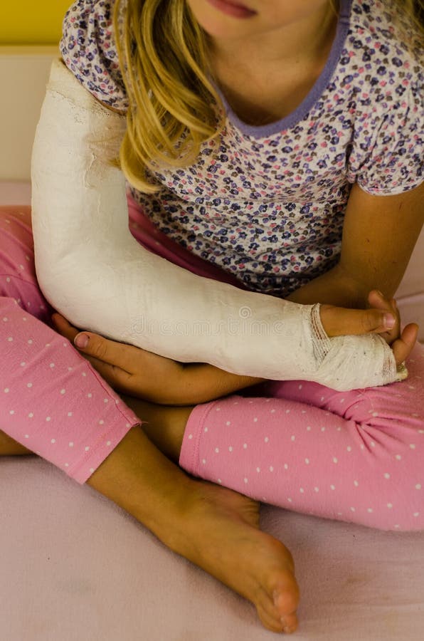 Broken hand stock image. Image of broken, girl, brave - 59706351