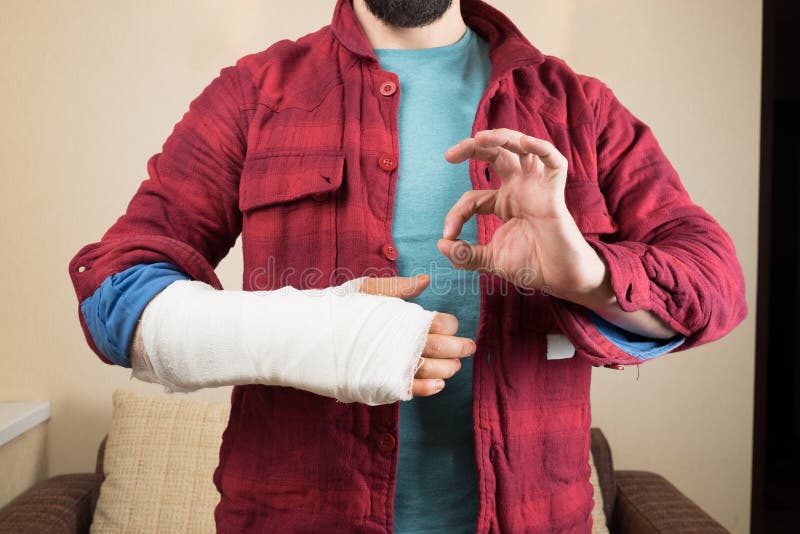Broken hand stock image. Image of gesture, plaster, pain - 69476245