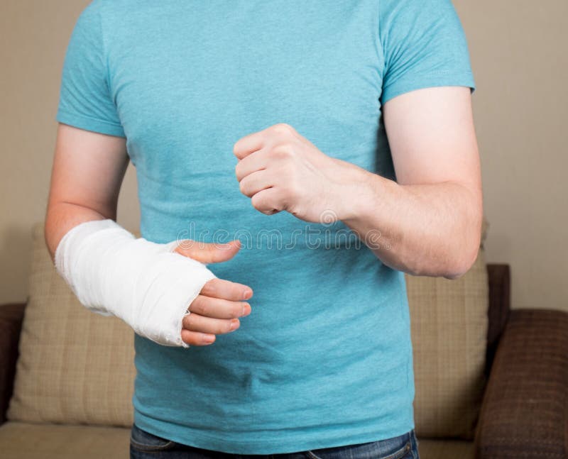 Broken hand sign stock photo. Image of cast, medical - 69773020
