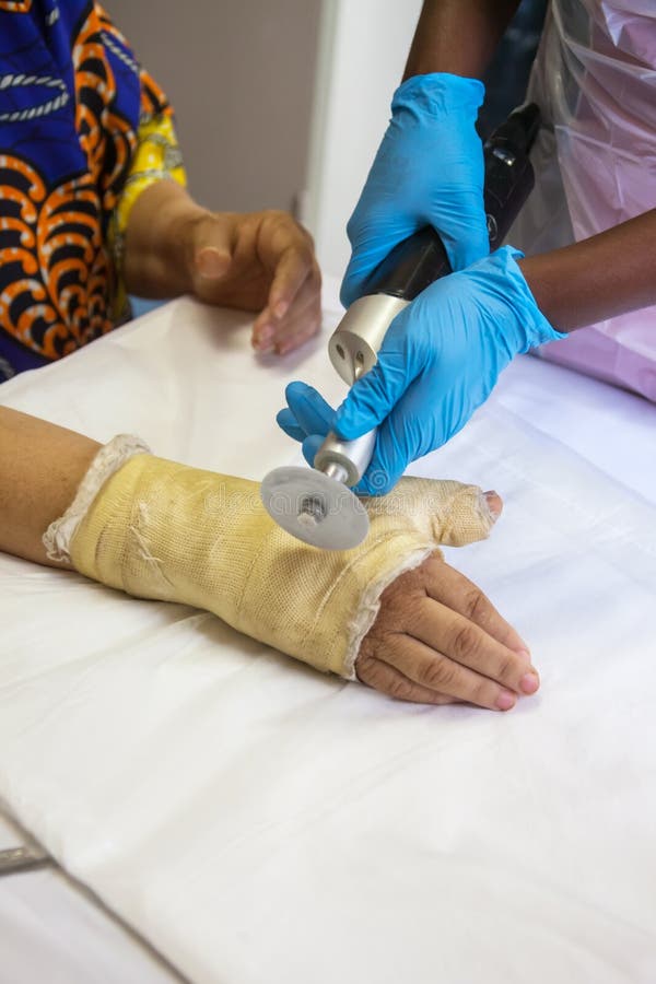 Broken hands stock image. Image of health, fracture - 165212865