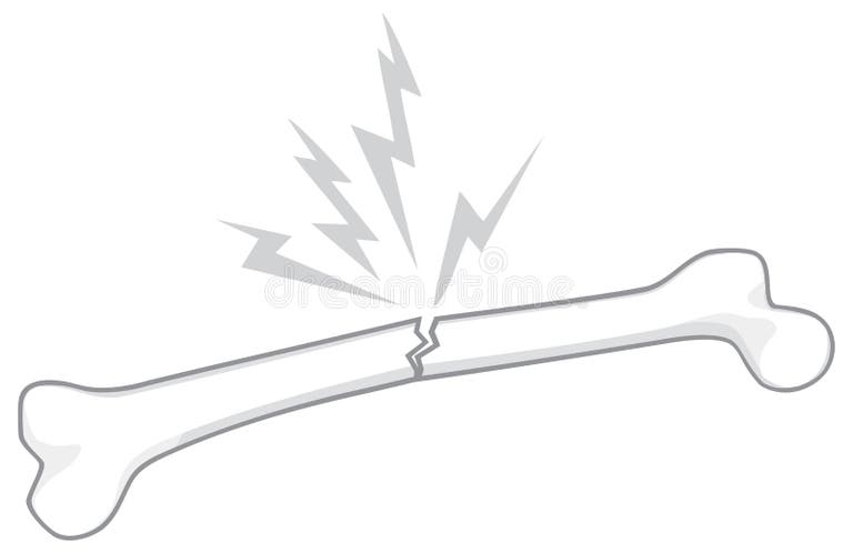 Broken Bone Design Stock Illustrations – 4,051 Broken Bone Design Stock ...