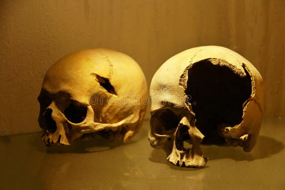 Broken Human Skull in a Show-case Stock Image - Image of death, broken ...