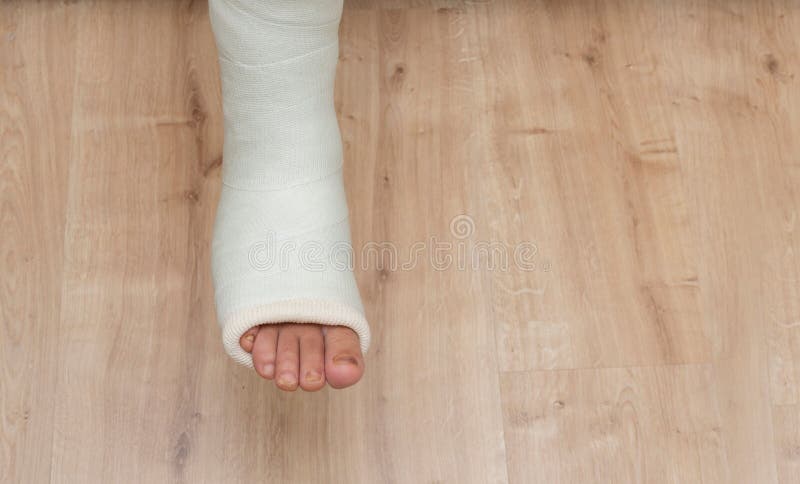 Broken Leg Ankle and Foot Splint Bandage on it Stock Image - Image of ...