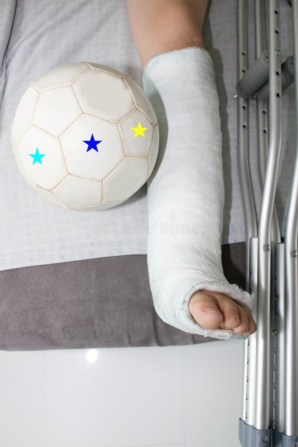 Detail Left Leg or in White Plaster Placed and Kick Ball. Stock Image ...