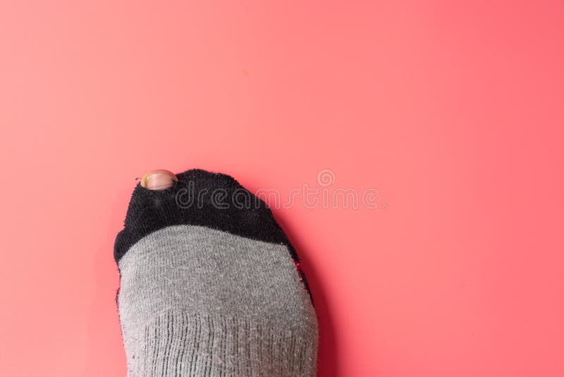 Broken Sock with a Hole in a Female Legs. Holes on the Heels of the ...