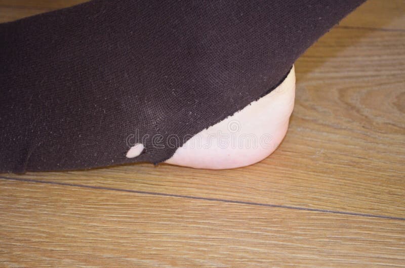 Broken sock on male leg stock image. Image of business - 128336825