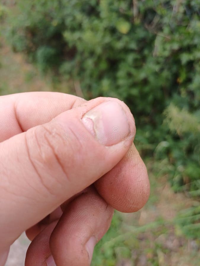 Broken Thumbnail Stock Photos - Free & Royalty-Free Stock Photos from ...