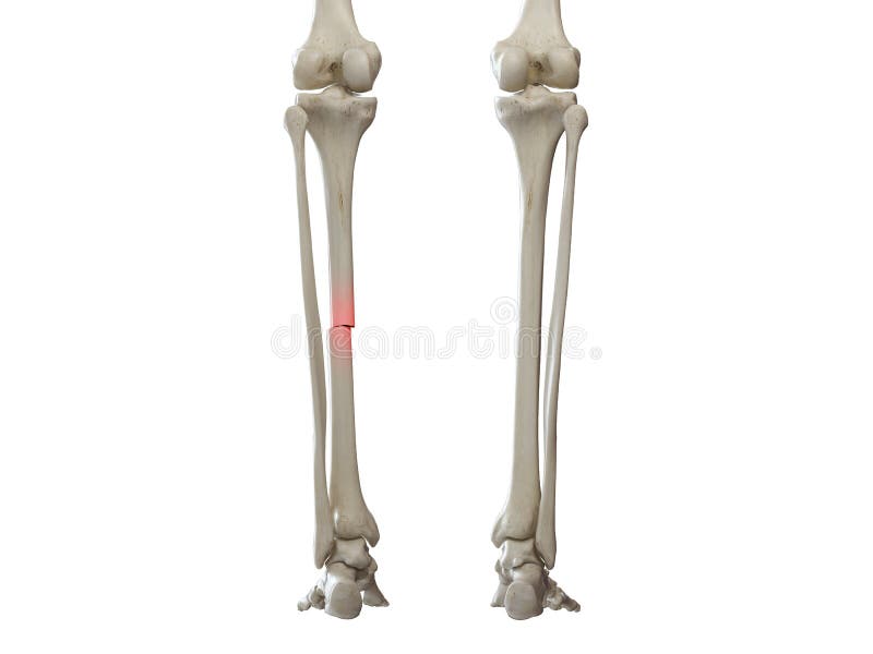 Tibia Stock Illustrations – 6,280 Tibia Stock Illustrations, Vectors ...