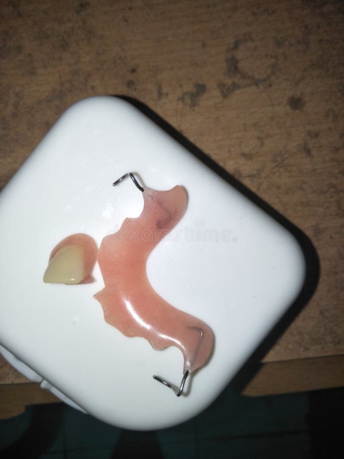 Broken Tooth Mold with Red Colour Stock Photo - Image of broken, mold ...