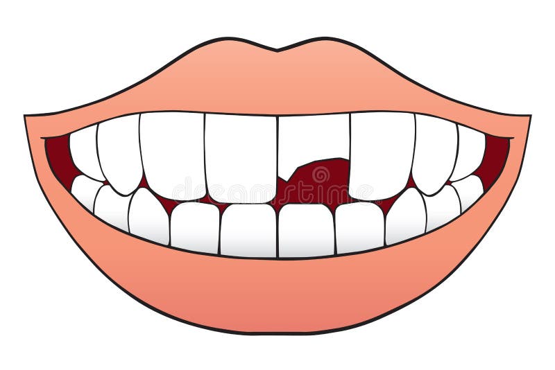 Half Tooth Stock Illustrations – 196 Half Tooth Stock Illustrations ...