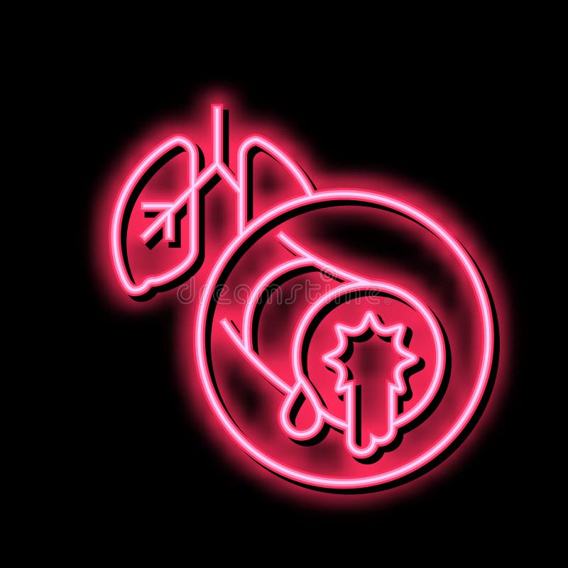 Bronchiectasis Respiratory Disease Neon Glow Icon Illustration Stock ...