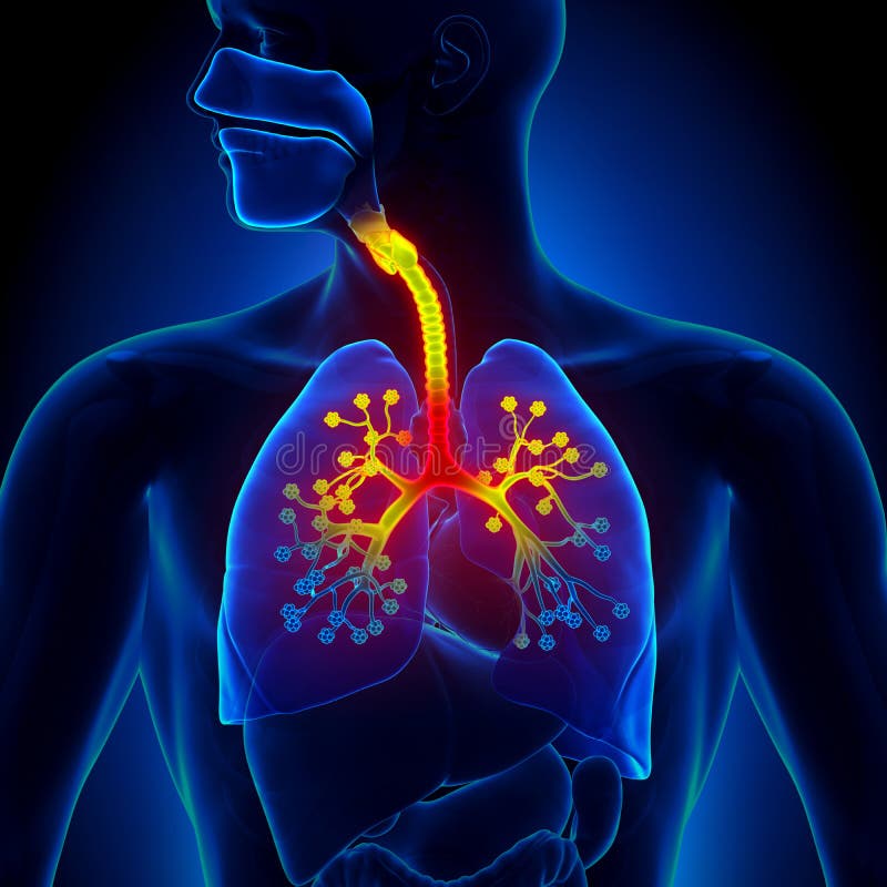 Bronchiolite - Inflammation Des Bronchioles Illustration Stock ...