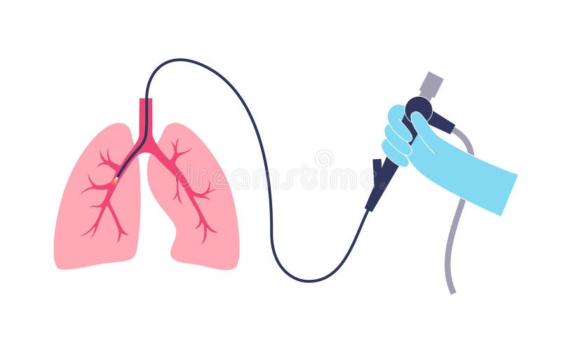 Biopsy Procedure Stock Illustrations – 255 Biopsy Procedure Stock ...