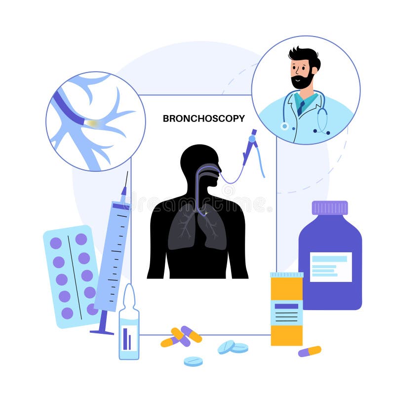 Bronchoscopy Vector Stock Illustrations – 162 Bronchoscopy Vector Stock ...