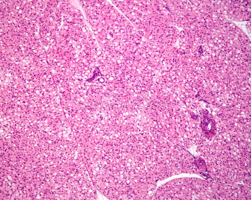 Brown adipose tissue stock photo. Image of microscopy - 310913828