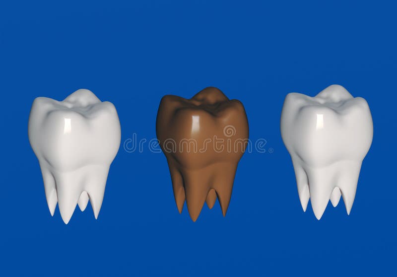 Brown Affected Tooth. 3d Illustration Stock Illustration - Illustration ...