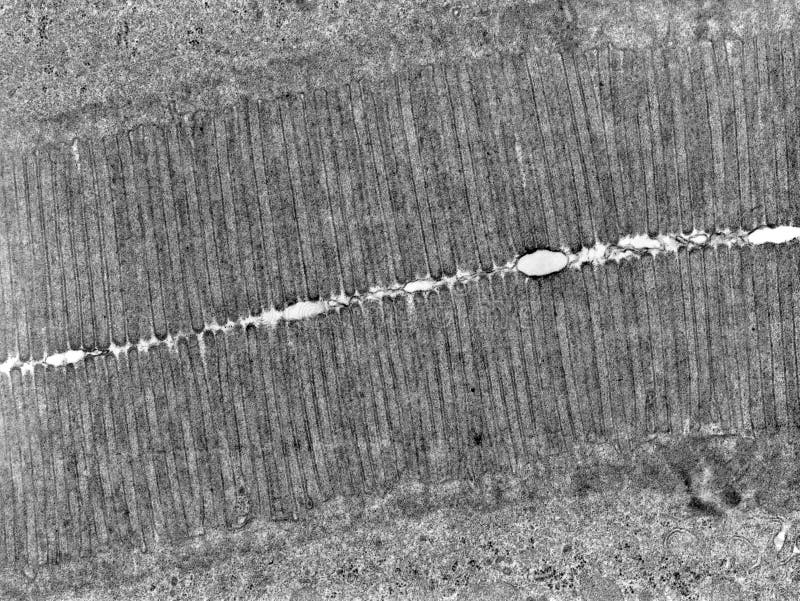 Brush border, TEM stock photo. Image of microvilli, ultrastructure ...