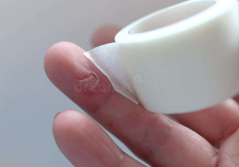 Bubble on the finger stock photo. Image of skin, finger - 113738760