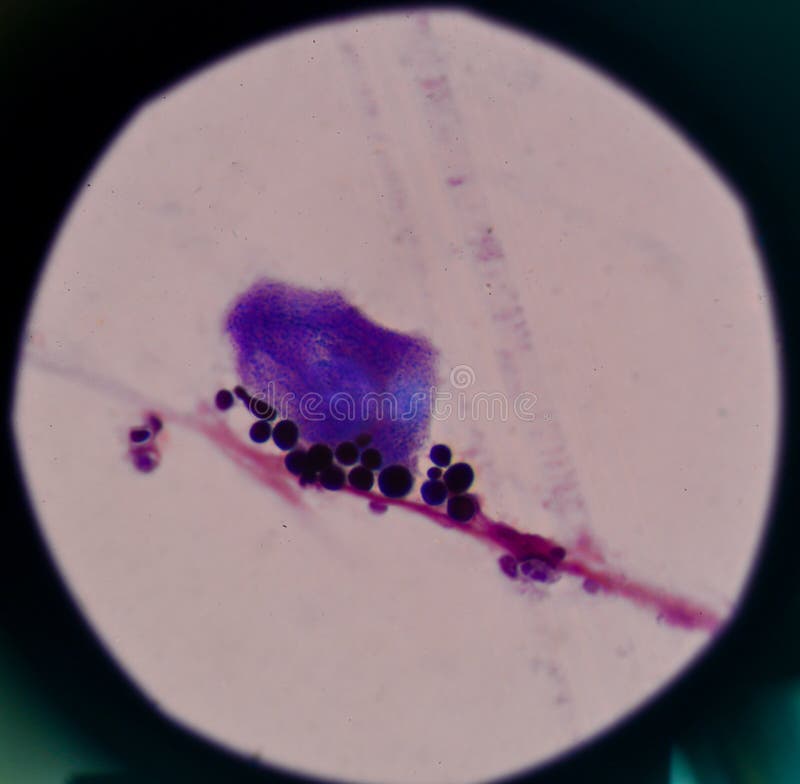 Budding Yeast Cell in Gram Stain Method. Stock Photo - Image of closeup ...